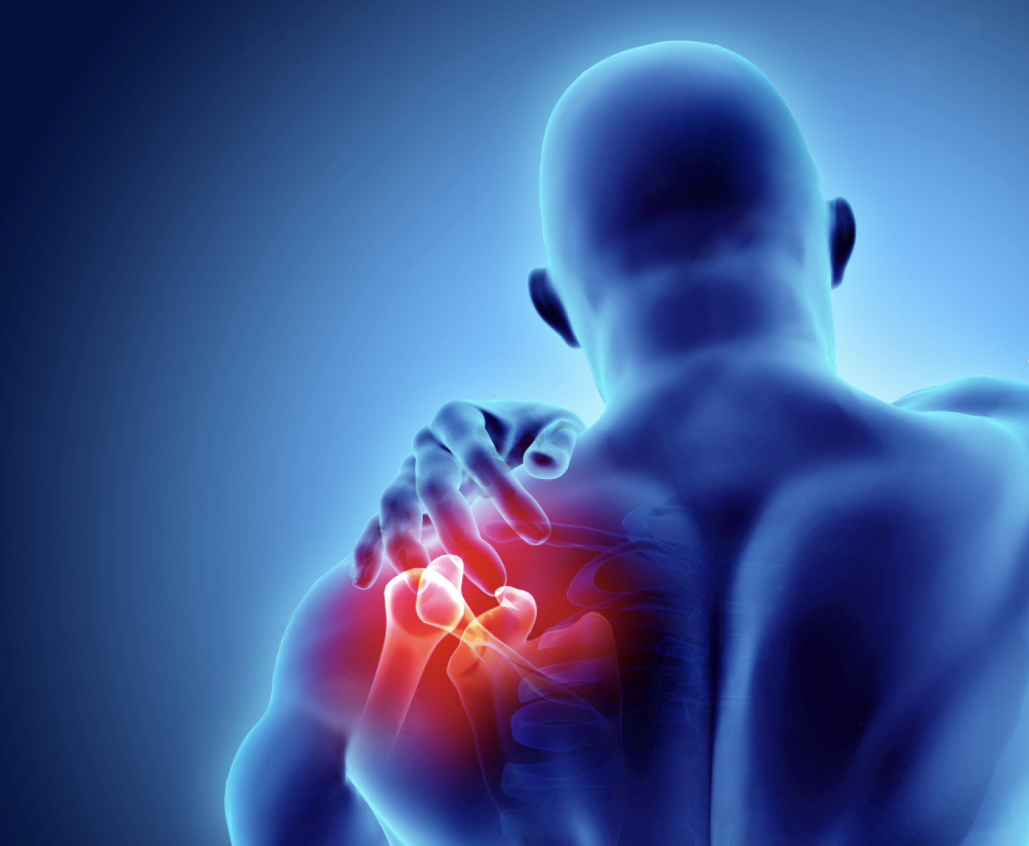 Tendinopatia Calcifica Spalla: Sintomi, Diagnosi e Litoclasia - Dr ...